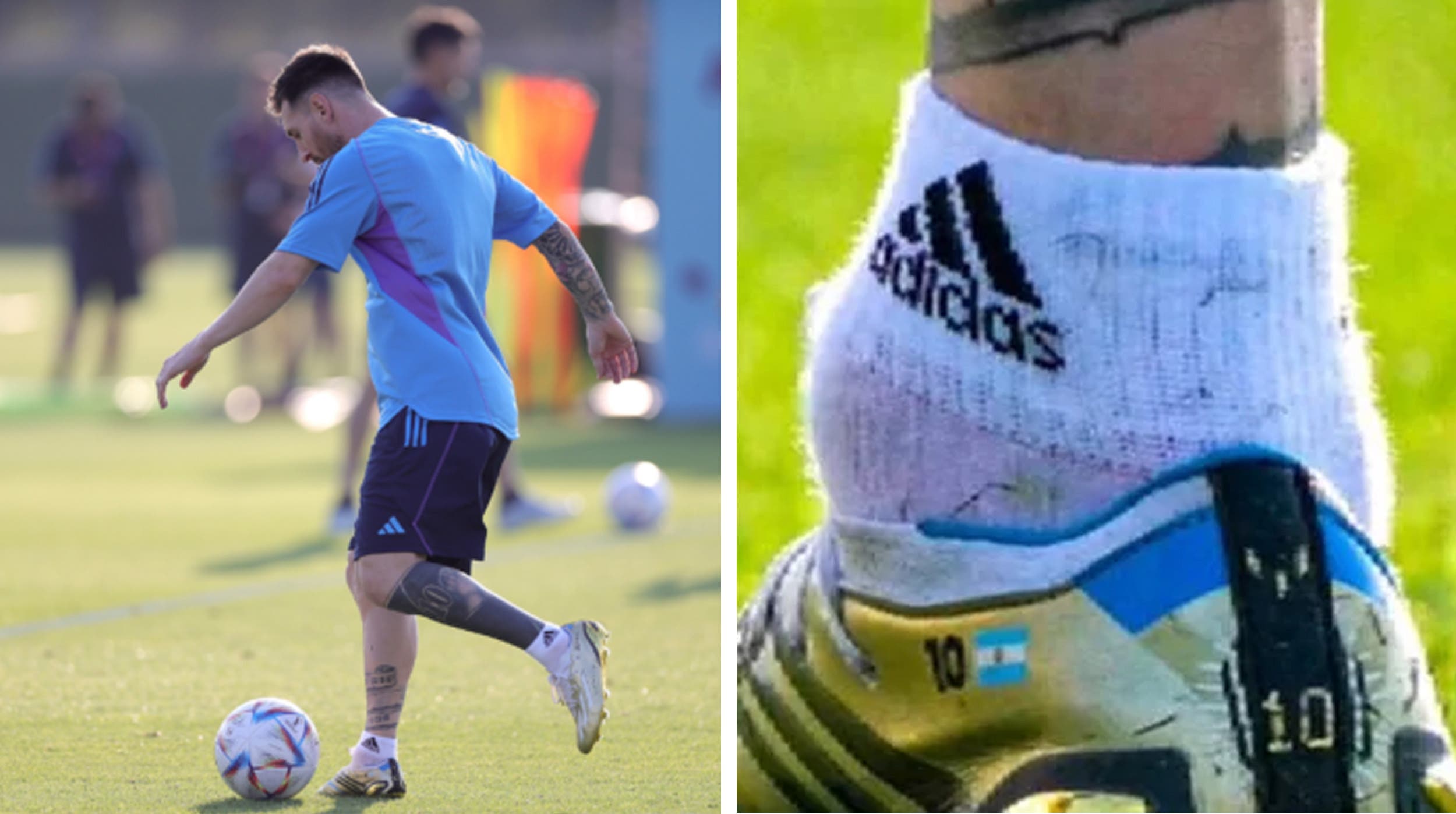 A horas de debutar, se viraliza foto del tobillo inflamado de Lionel ...