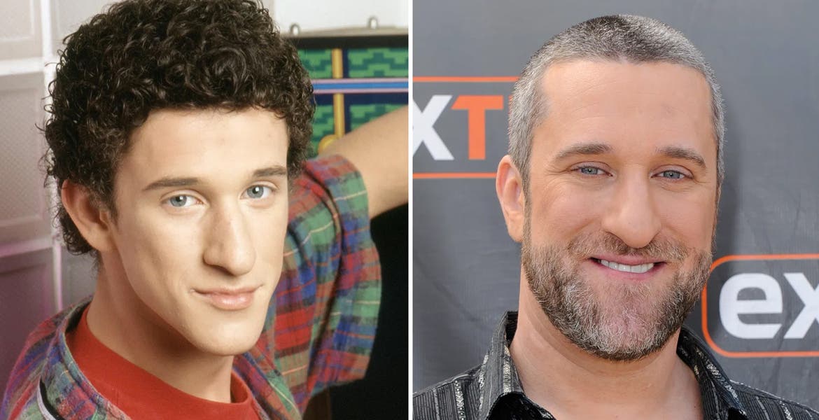 ¿De qué murió Dustin Diamond, actor de ‘Salvados por la Campana ...