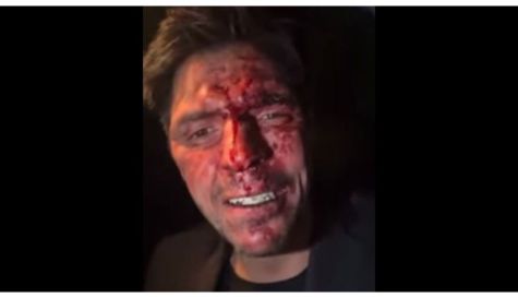 VIDEO: Golpean a hijo de Lupita D’Alessio: “Si me matan fue Arturo Montiel”
